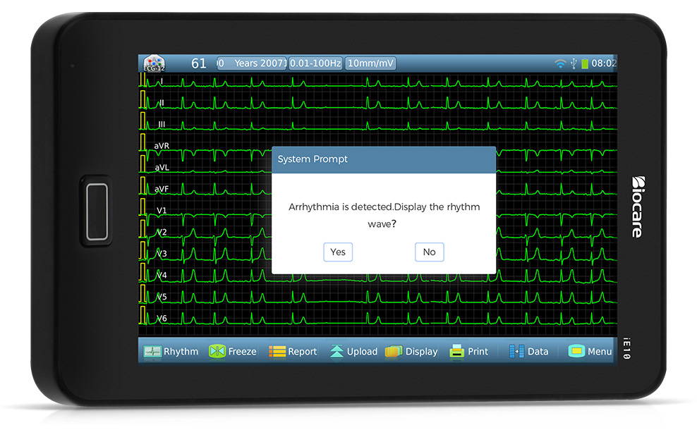 Point-of-Care 12-Lead ECG/EKG Machine Based on A Tablet, with Auto Interpretation & Analysis ...